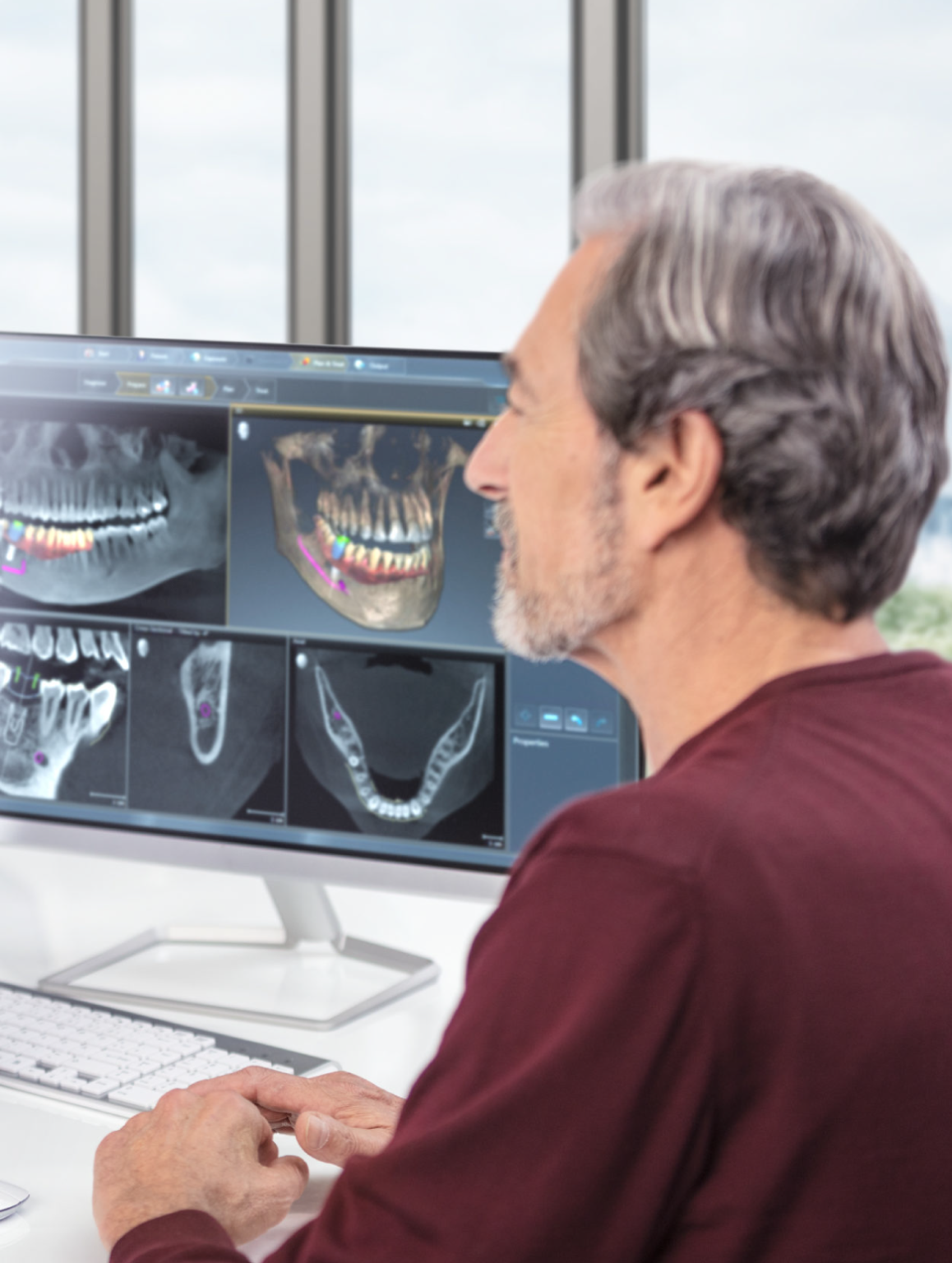 Cone Beam Computed Tomography (CBCT) | Syria Scan